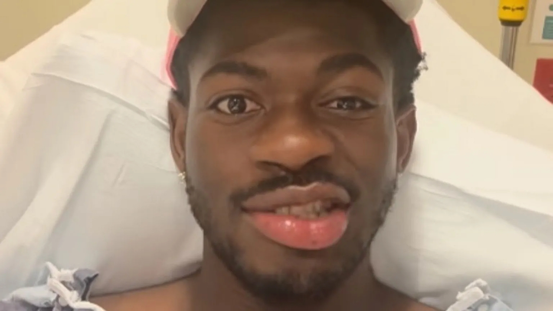 Rapper Lil Nas X Faces Partial Facial Paralysis, Stays Positive - The ...